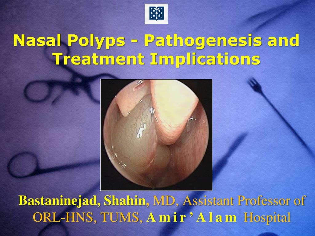 Ppt Nasal Polyps Pathogenesis And Treatment Implications Powerpoint