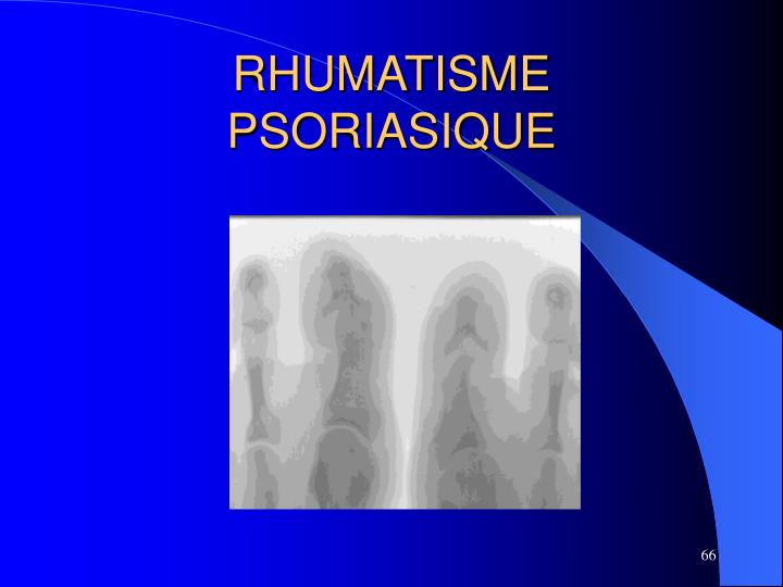 PPT - LES RHUMATISMES INFLAMMATOIRES PowerPoint Presentation - ID:4734688