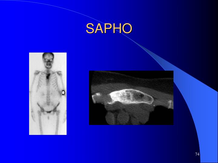 PPT - LES RHUMATISMES INFLAMMATOIRES PowerPoint Presentation - ID:4734688