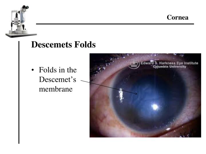 PPT - Slit Lamp Exam Findings PowerPoint Presentation - ID:4737512