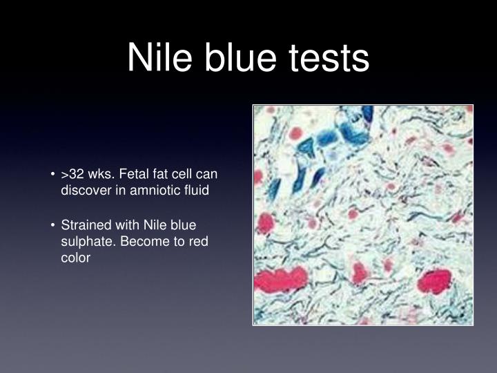 PPT - Preterm labor and PROM PowerPoint Presentation - ID:4740589