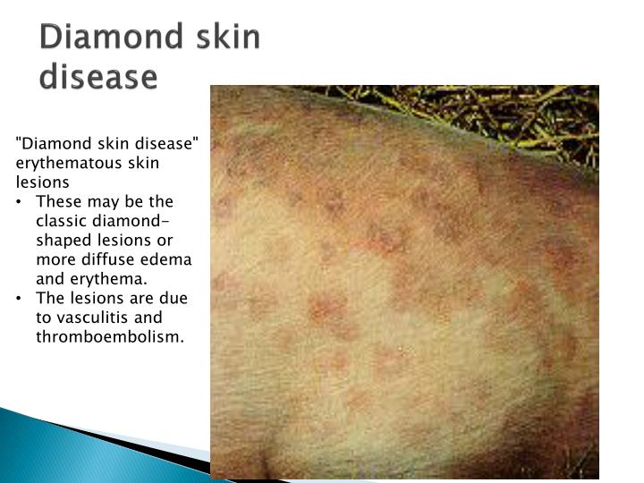 PPT - Swine diseases PowerPoint Presentation - ID:4741995