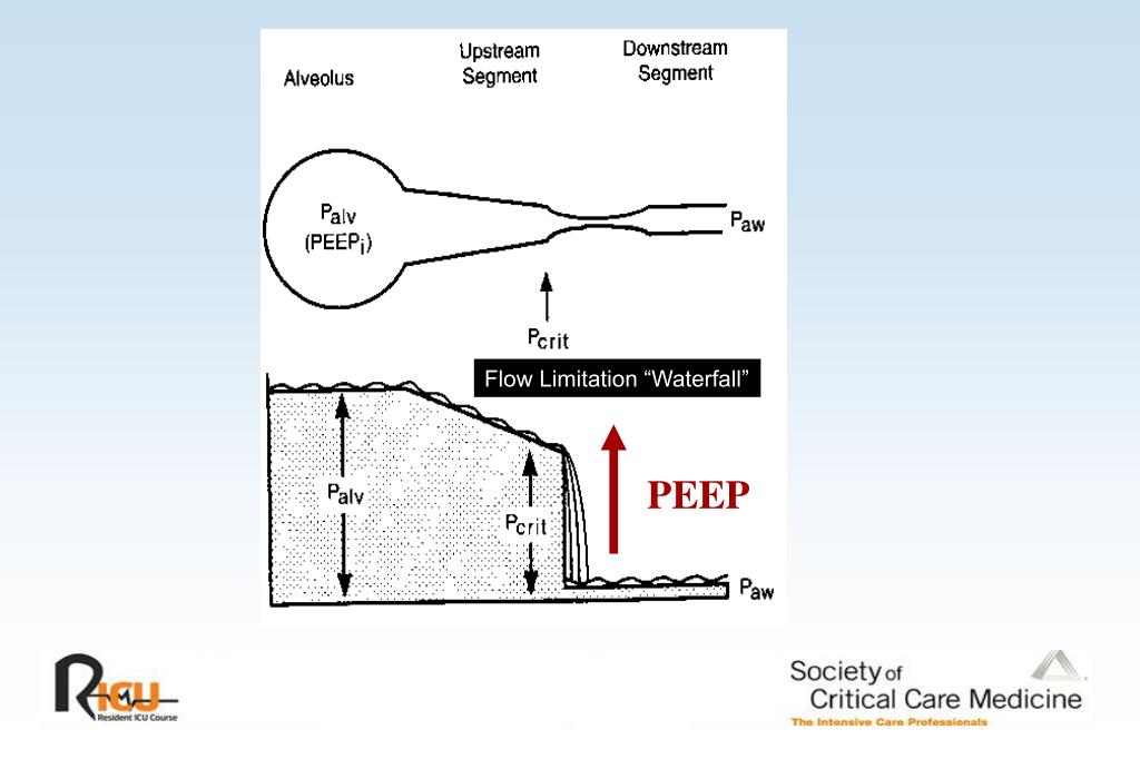 PPT - John J. Marini Alain F. Broccard University of Minnesota Regions ...