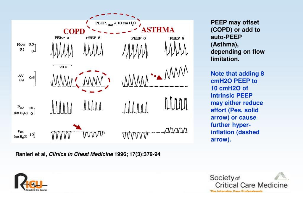 PPT - John J. Marini Alain F. Broccard University of Minnesota Regions ...