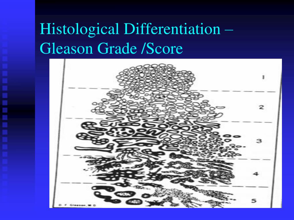 Ppt Urology And Male Health Powerpoint Presentation Free Download