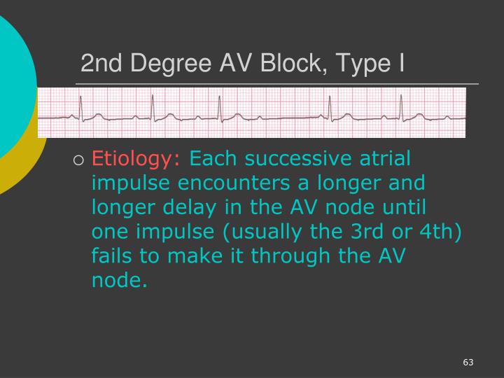 PPT - ECG interpretations PowerPoint Presentation - ID:4748872