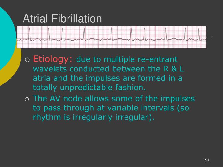 PPT - ECG interpretations PowerPoint Presentation - ID:4748872