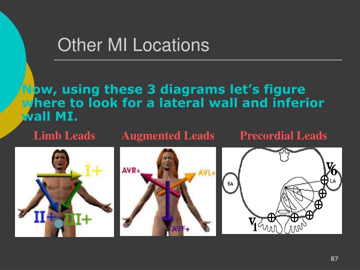 PPT - ECG interpretations PowerPoint Presentation - ID:4748872