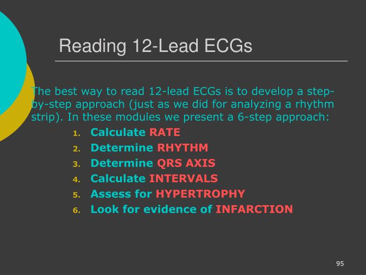PPT - ECG interpretations PowerPoint Presentation - ID:4748872
