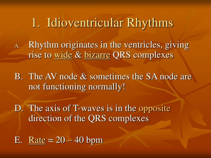 PPT - DIAGNOSIS OF CARDIAC RHYTHMS PowerPoint Presentation - ID:4749015