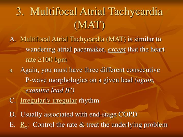 PPT - DIAGNOSIS OF CARDIAC RHYTHMS PowerPoint Presentation - ID:4749015