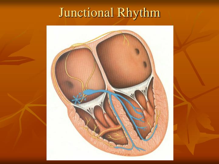 PPT - DIAGNOSIS OF CARDIAC RHYTHMS PowerPoint Presentation - ID:4749015