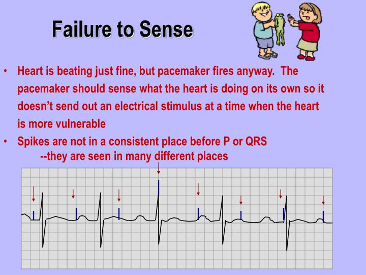 PPT - Jan Hovekamp, RN, Clinical Educator for Telemetry Services St ...
