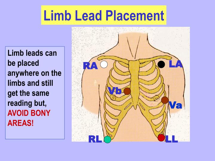 PPT - Jan Hovekamp, RN, Clinical Educator for Telemetry Services St ...