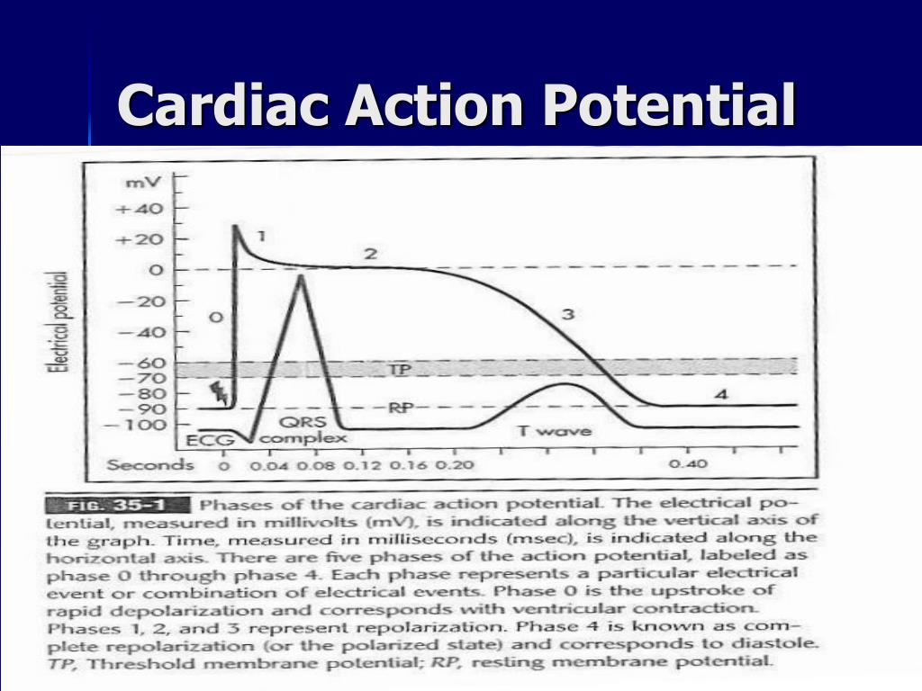 PPT - Coronary Artery Disease Complications Cardiac Arrhythmias ...