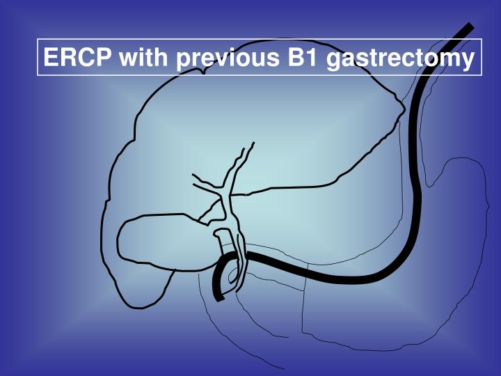 PPT - Biliary Pathology PowerPoint Presentation - ID:4749852