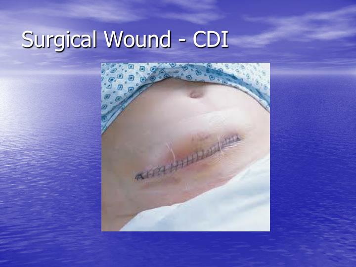 PPT - Wounds and skin PowerPoint Presentation - ID:4750054