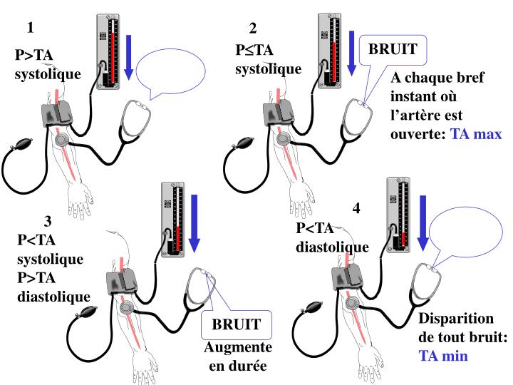 PPT - BIOPHYSIQUE DE LA CIRCULATION Mécanique des fluides Hémodynamique ...