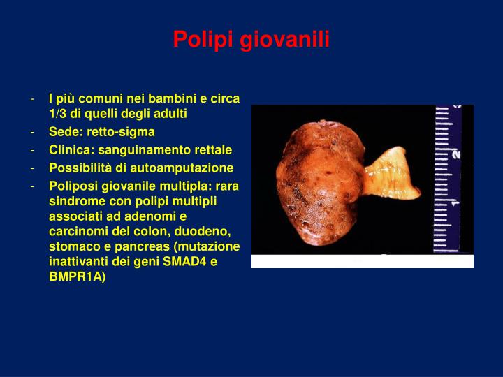 PPT - Neoplasie del Colon PowerPoint Presentation - ID:4750693