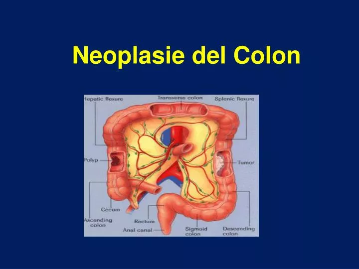 PPT - Neoplasie del Colon PowerPoint Presentation, free download - ID ...