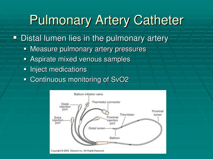 PPT - Hemodynamic Monitoring PowerPoint Presentation - ID:4750943