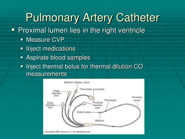 PPT - Hemodynamic Monitoring PowerPoint Presentation - ID:4750943