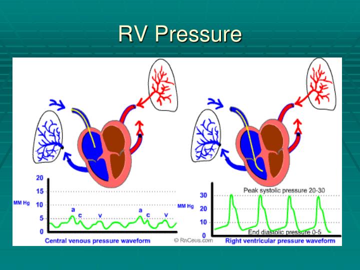 PPT - Hemodynamic Monitoring PowerPoint Presentation - ID:4750943