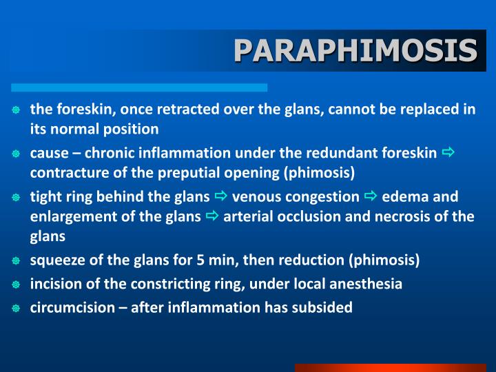 PPT - TESTICULAR TUMORS & DISORDERS OF EXTERNAL GENITALIA PowerPoint ...
