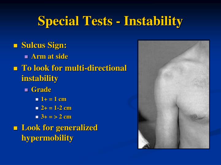 PPT - Shoulder 101 …and Then Some PowerPoint Presentation - ID:4752721