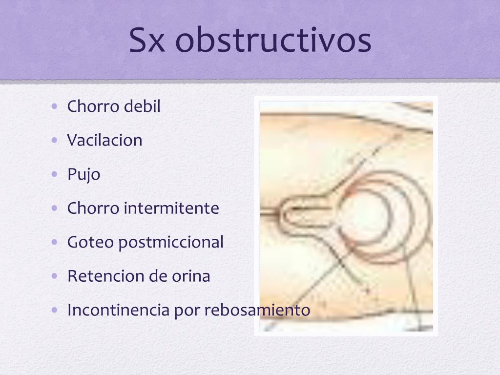 PPT - Semiologia del aparato genito-urinario PowerPoint Presentation ...