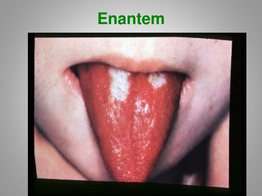 PPT - DERMATOLOJİK MUAYENE ve TANI YÖNTEMLERİ Prof. Dr. Mustafa ŞENOL ...