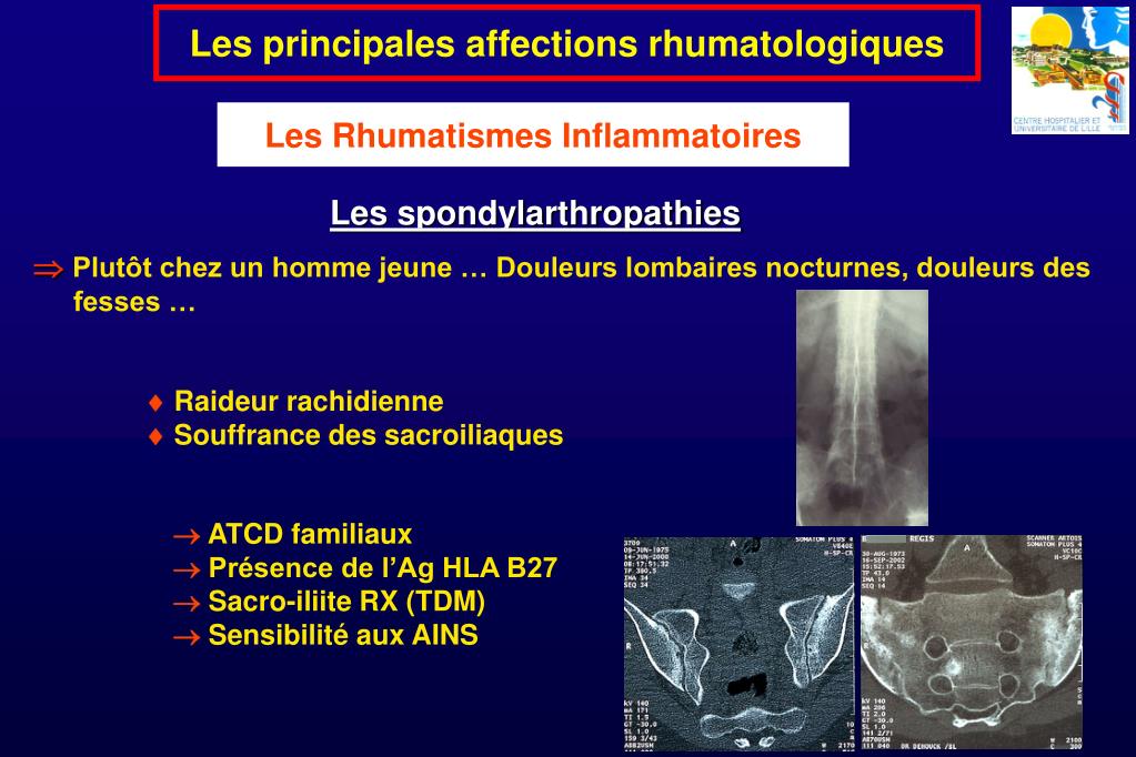 PPT - La rhumatologie : quelques mots d’histoire PowerPoint ...