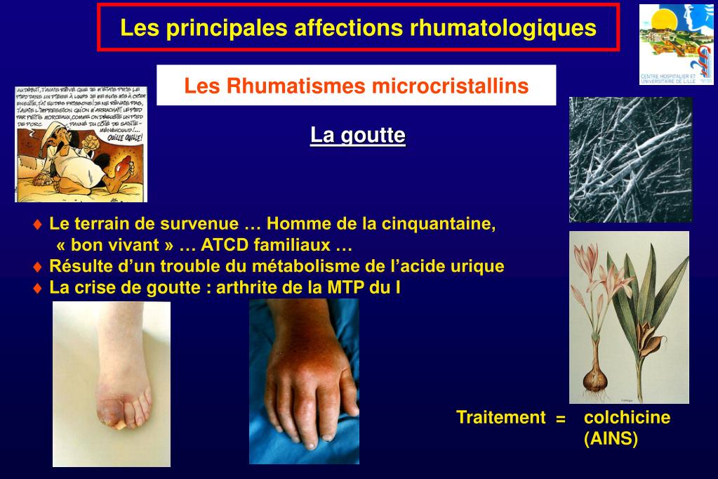 PPT - La rhumatologie : quelques mots d’histoire PowerPoint ...