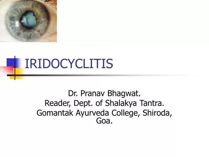 PPT - IRIDOCYCLITIS PowerPoint Presentation, free download - ID:4760201