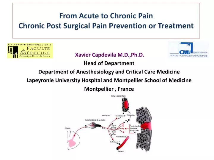 PPT - From Acute to Chronic Pain Chronic Post Surgical Pain Prevention ...
