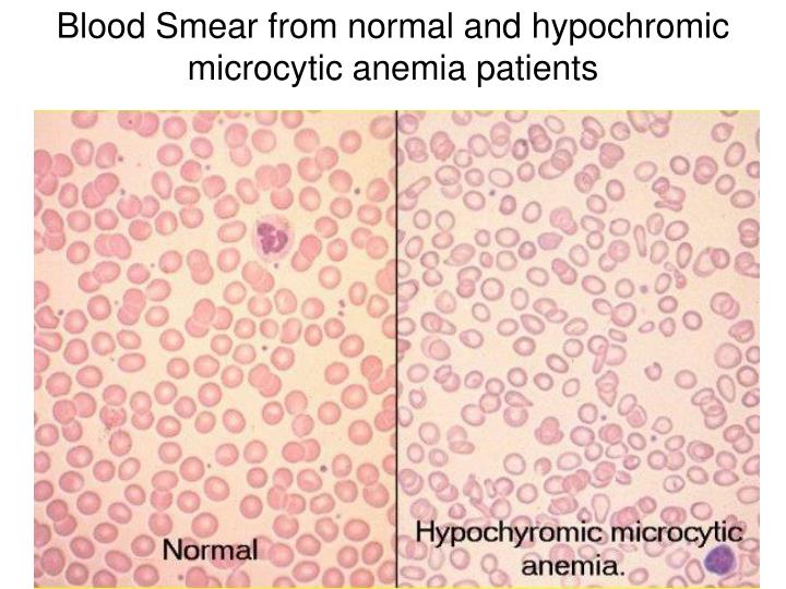 PPT - Blood PowerPoint Presentation - ID:4764735