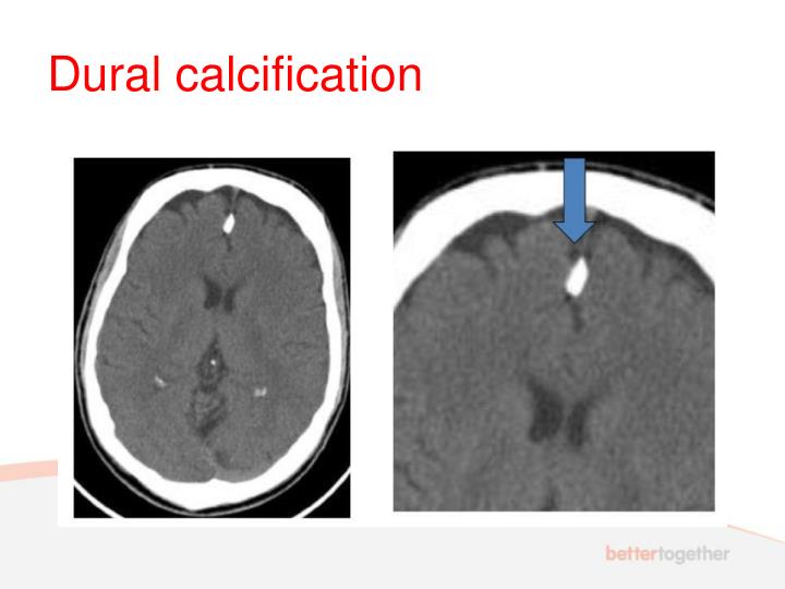 PPT - CT for ADIS Module PowerPoint Presentation - ID:4764945