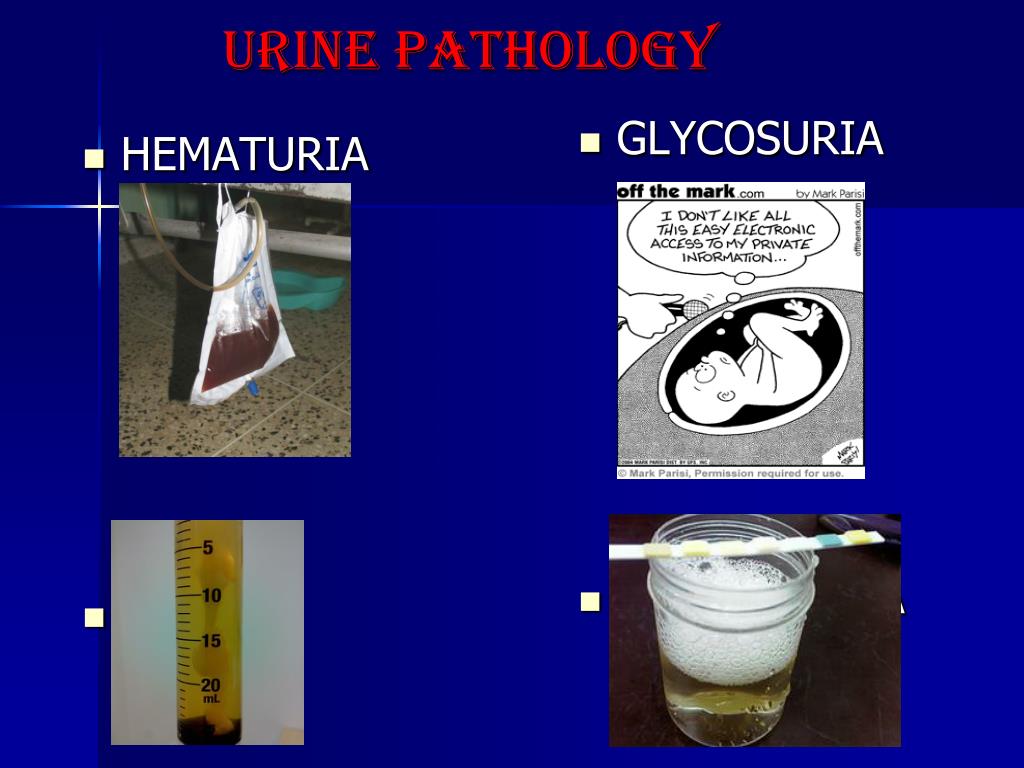 PPT - PRODUCTION OF URINE PowerPoint Presentation, free download - ID ...