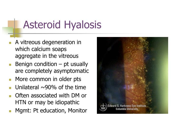 PPT - Vitreous & Peripheral Retinal Anomalies PowerPoint Presentation ...