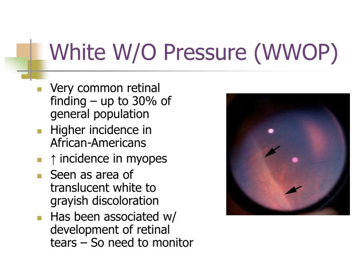 PPT - Vitreous & Peripheral Retinal Anomalies PowerPoint Presentation ...