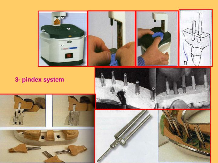PPT - fixed prosthodontics PowerPoint Presentation - ID:4786165
