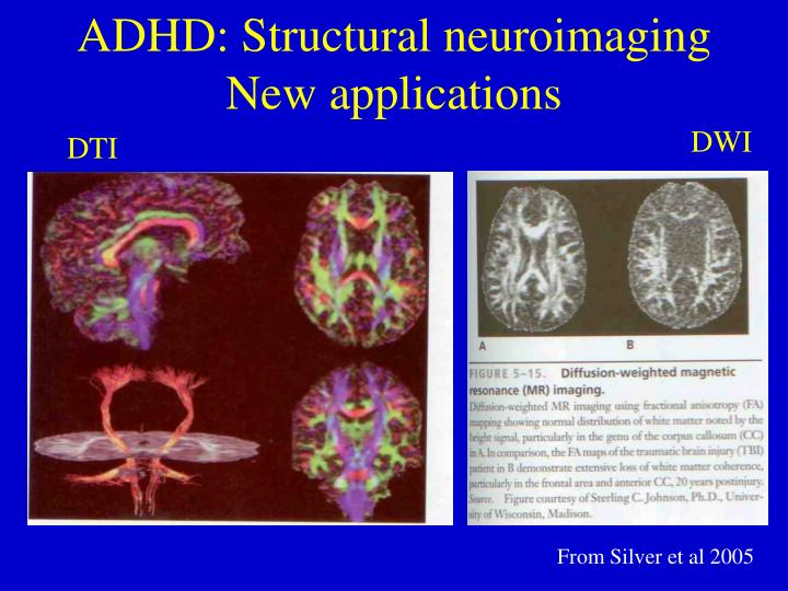 PPT - Neuropsychology & Cognitive Neuroscience of ADHD PowerPoint ...