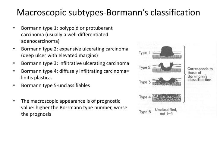 PPT - 1. Stomach and 2. esophageal cancer PowerPoint Presentation - ID ...