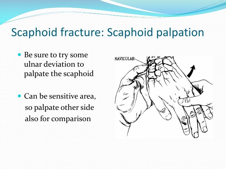 PPT - Common Fracture Management PowerPoint Presentation - ID:4789115