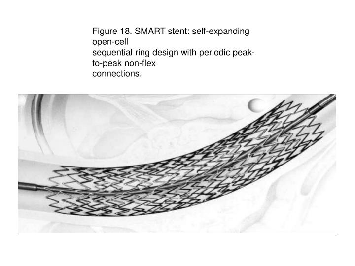PPT - NITINOL PowerPoint Presentation - ID:4789177