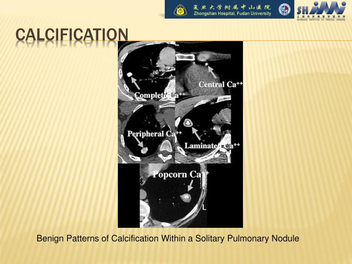 PPT - Radiology of Respiratory System PowerPoint Presentation - ID:4792657