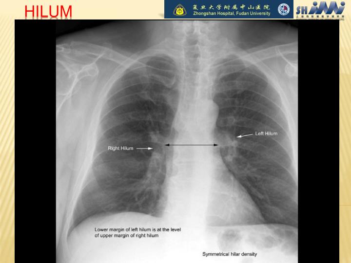 PPT - Radiology of Respiratory System PowerPoint Presentation - ID:4792657