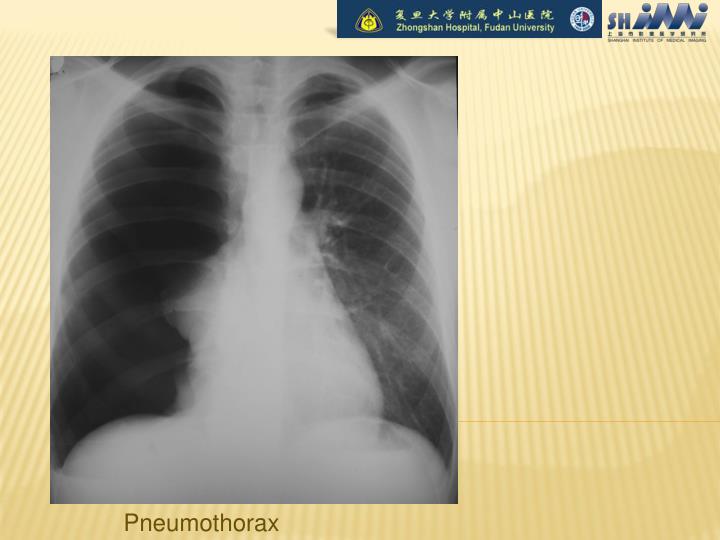PPT - Radiology of Respiratory System PowerPoint Presentation - ID:4792657