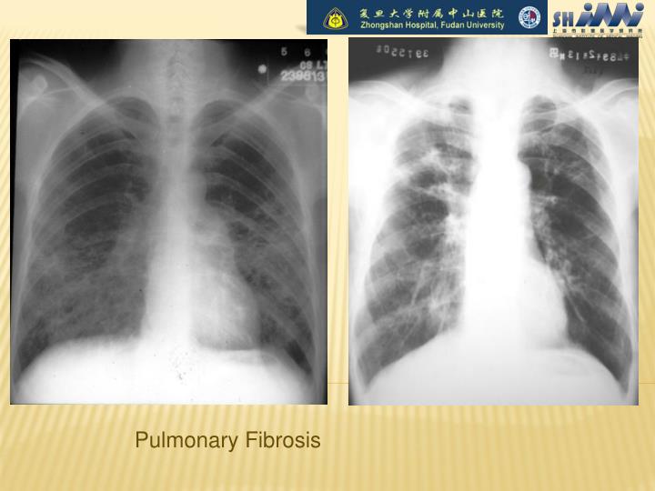 PPT - Radiology of Respiratory System PowerPoint Presentation - ID:4792657