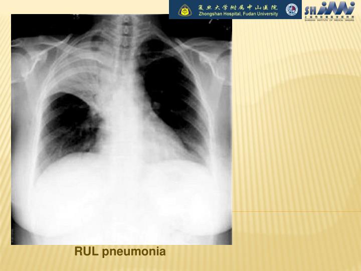 PPT - Radiology of Respiratory System PowerPoint Presentation - ID:4792657